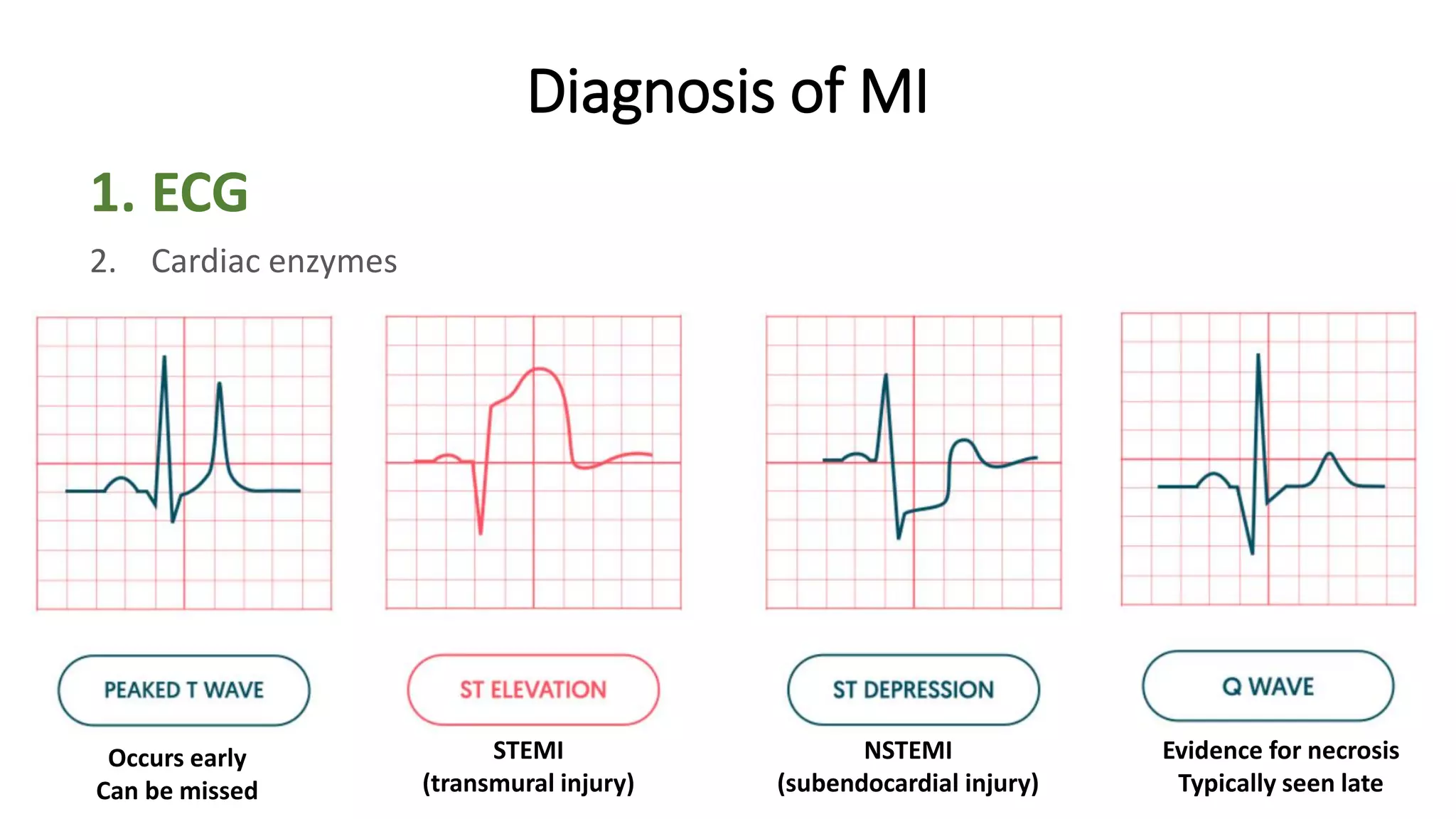 Acute Coronary Syndrome | PDF