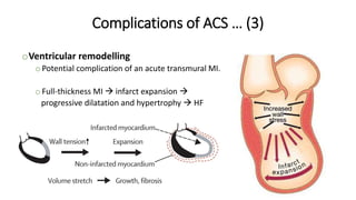 Acute Coronary Syndrome | PDF
