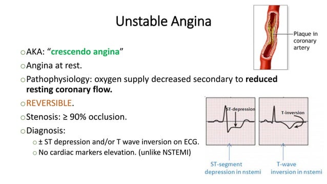 Acute Coronary Syndrome | PDF | Heart and Cardiovascular Diseases ...
