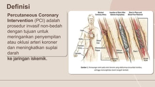 Acute Coronary Syndrome.pptx
