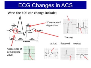 ACUTE CORONARY SYNDROME.pptx