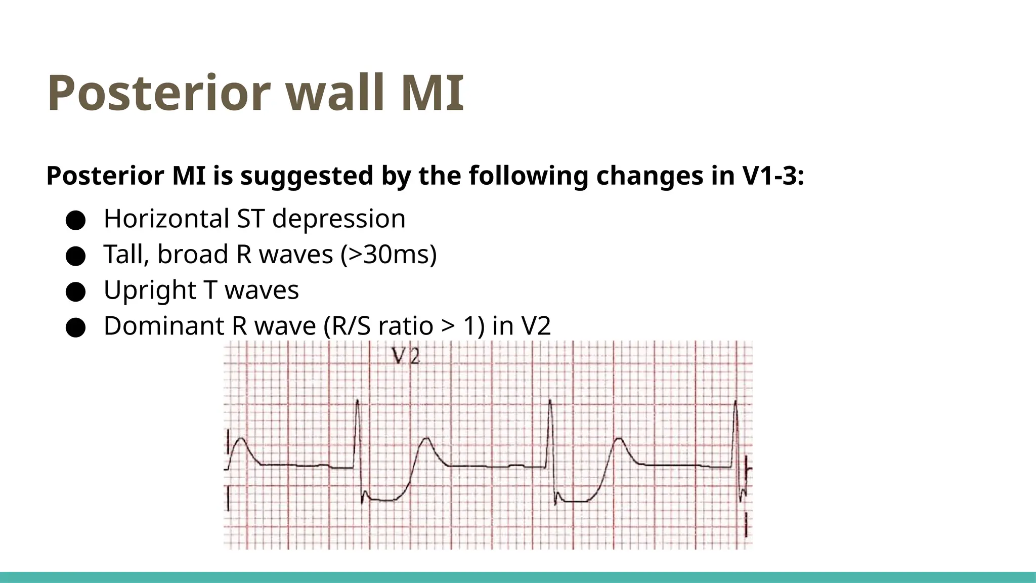 ACUTE CORONARY SYNDROME BY DR.NITHA , 2022 | PPTX
