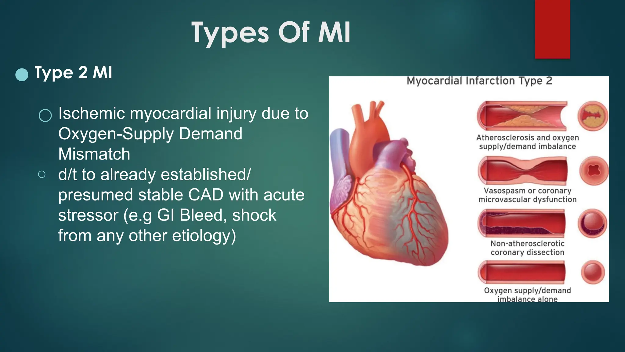 Acute Coronary Syndrome based on ESC 2023 guidelines on the management ...