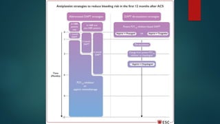 Acute Coronary Syndrome based on ESC 2023 guidelines on the management ...