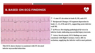 Acute Coronary Syndrome myocardial infarction .pptx