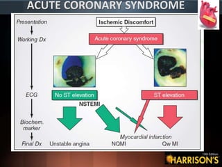 Acute coronary syndrome | PPTX