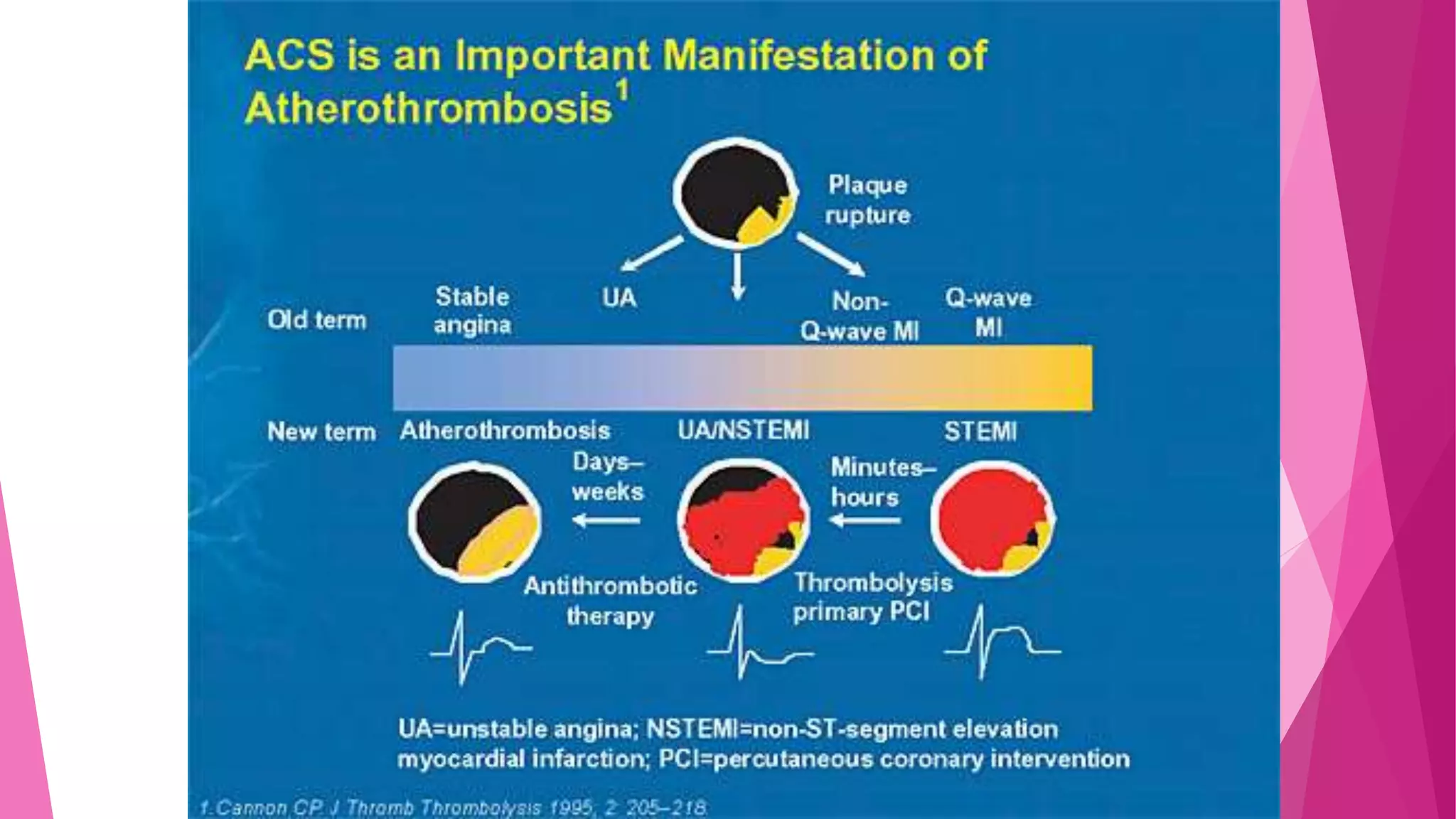 Acute coronary syndrome (acs) | PPTX | Heart and Cardiovascular ...