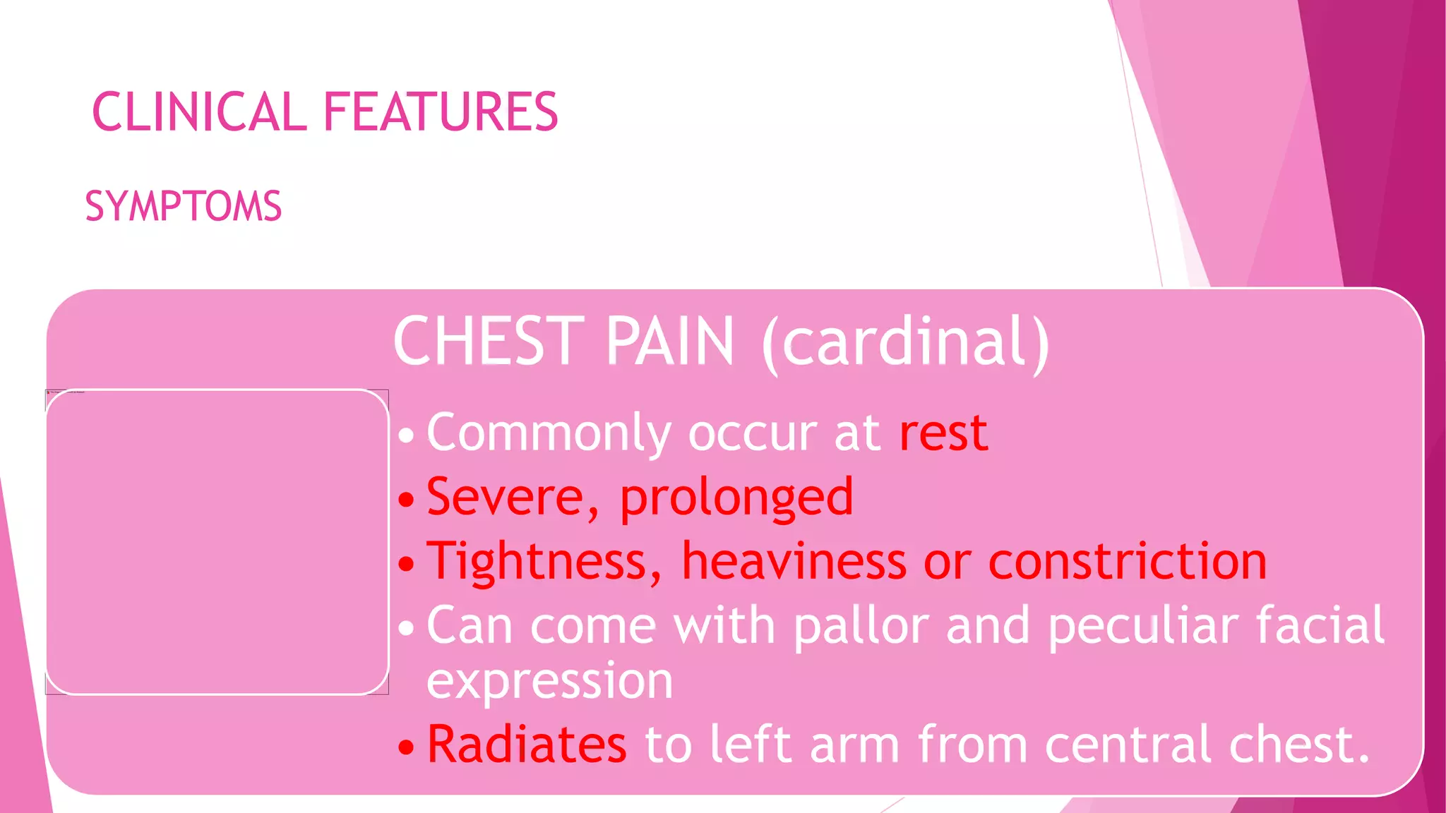 Acute coronary syndrome (acs) | PPTX