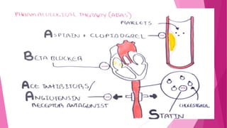 Acute coronary syndrome (acs) | PPTX