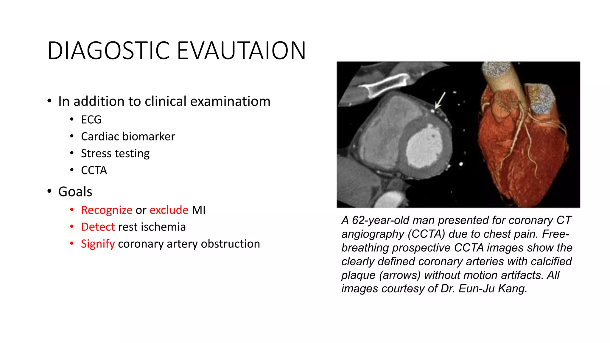 Acute coronary syndrome (acs) | PPTX