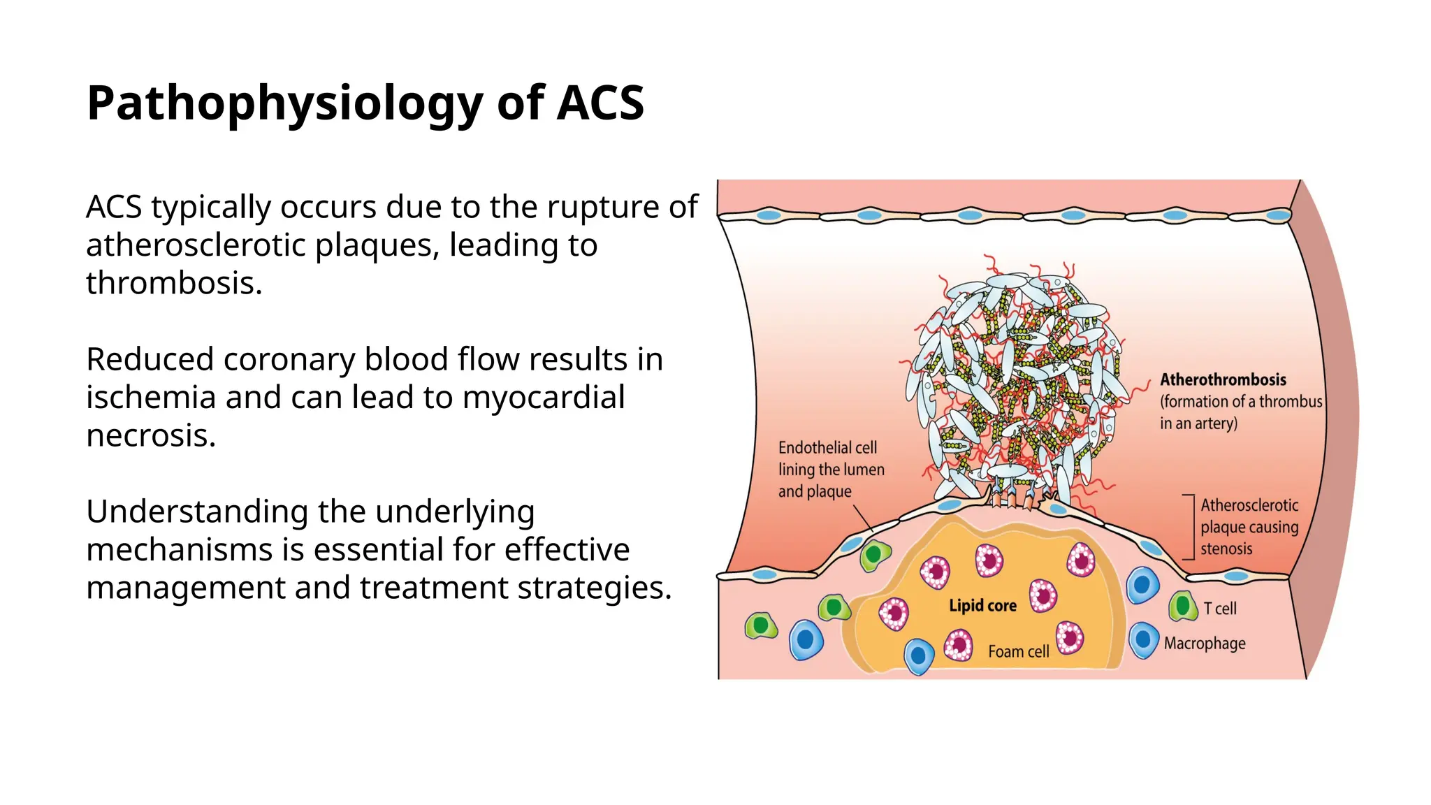 Acute Coronary Syndrome And Related Drugs And Their Effects..pptx