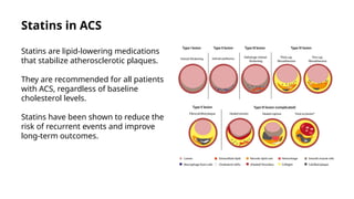 Acute Coronary Syndrome And Related Drugs And Their Effects..pptx
