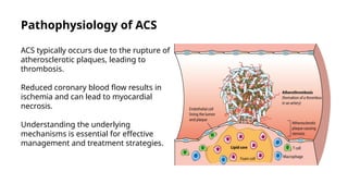 Acute Coronary Syndrome And Related Drugs And Their Effects..pptx