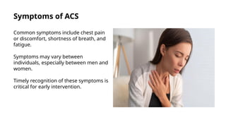 Acute Coronary Syndrome And Related Drugs And Their Effects..pptx