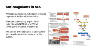 Acute Coronary Syndrome And Related Drugs And Their Effects..pptx