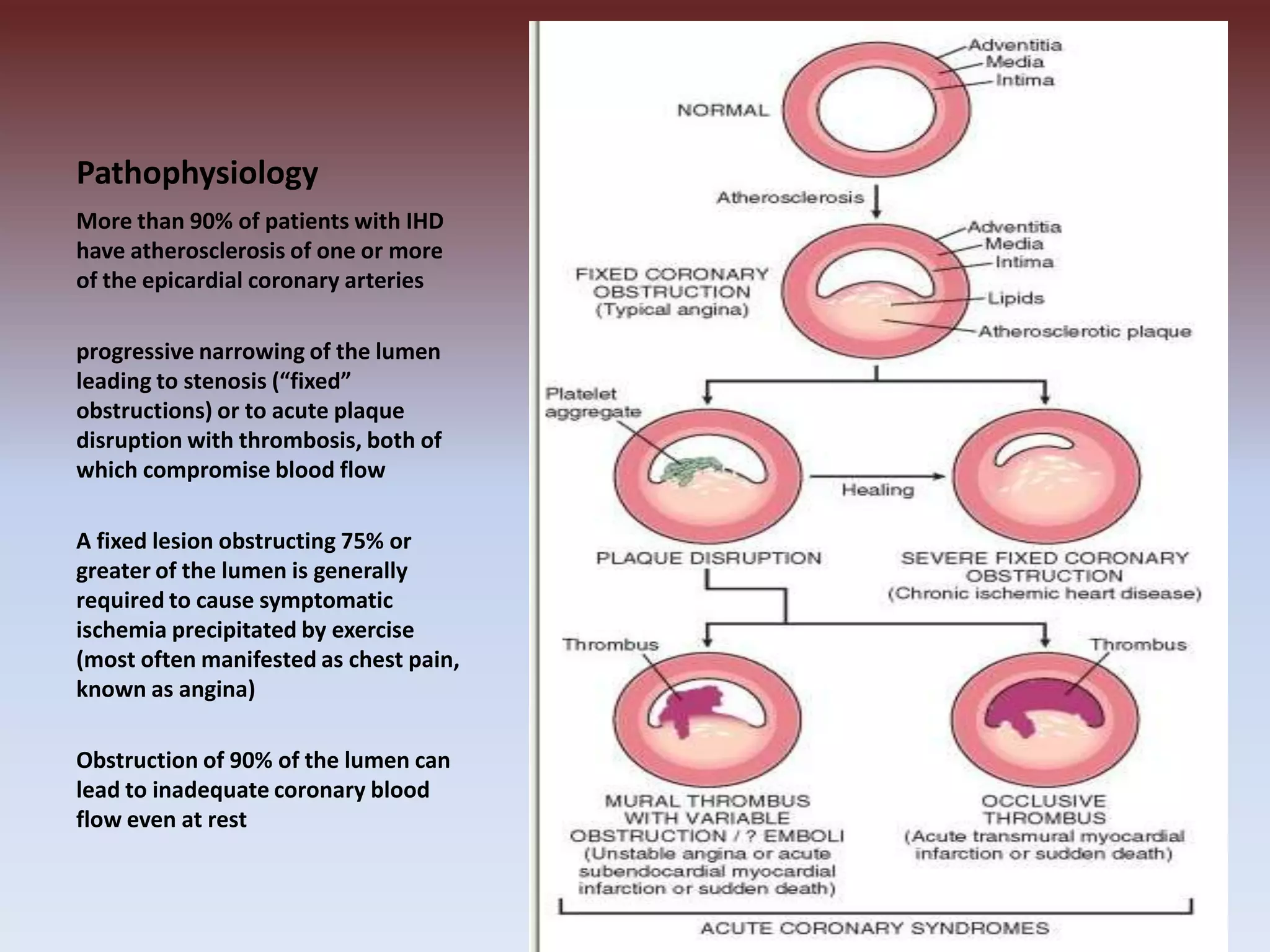 Acute coronary syndrome NSTEMI | PPTX