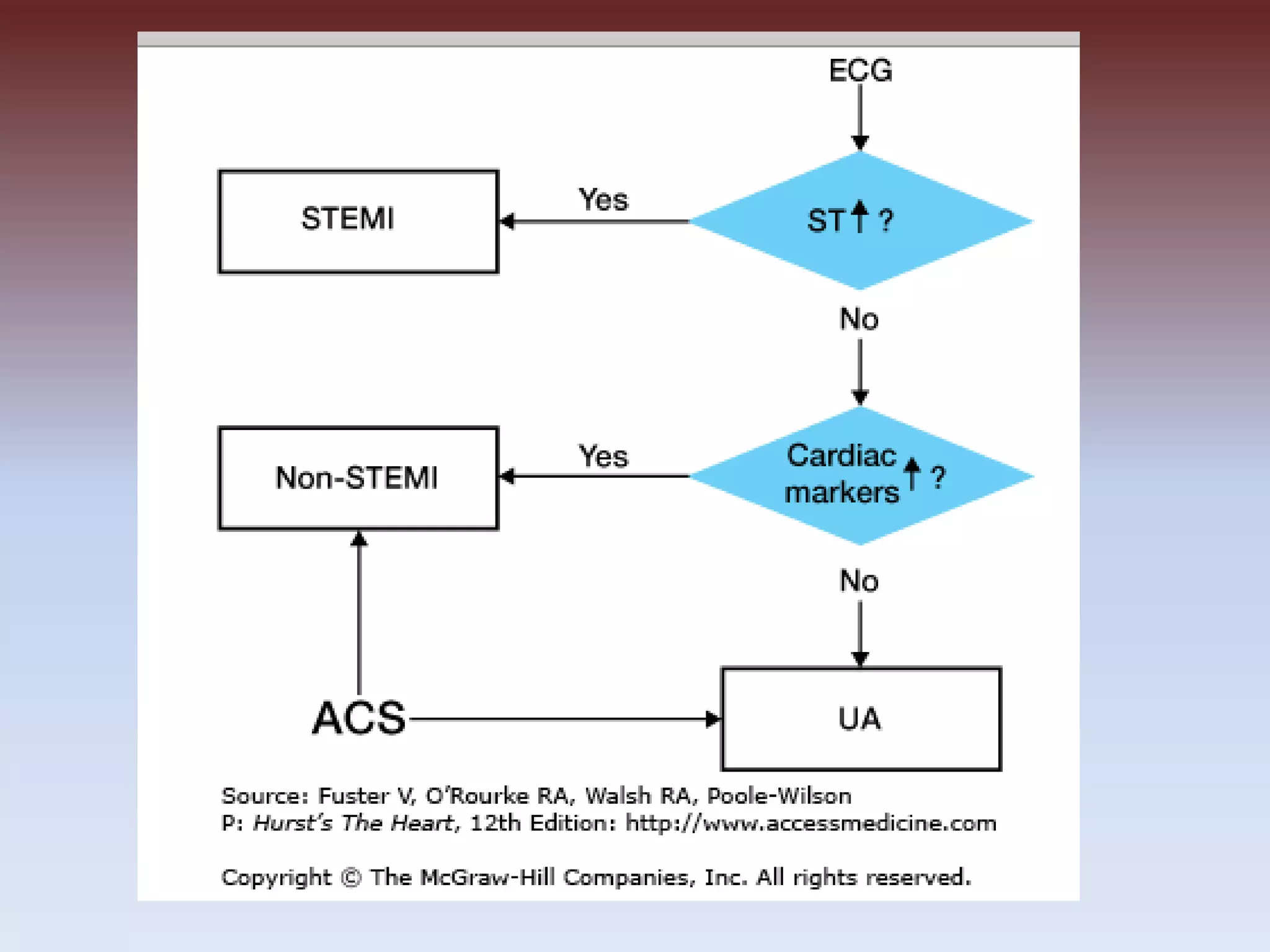 Acute coronary syndrome NSTEMI | PPTX