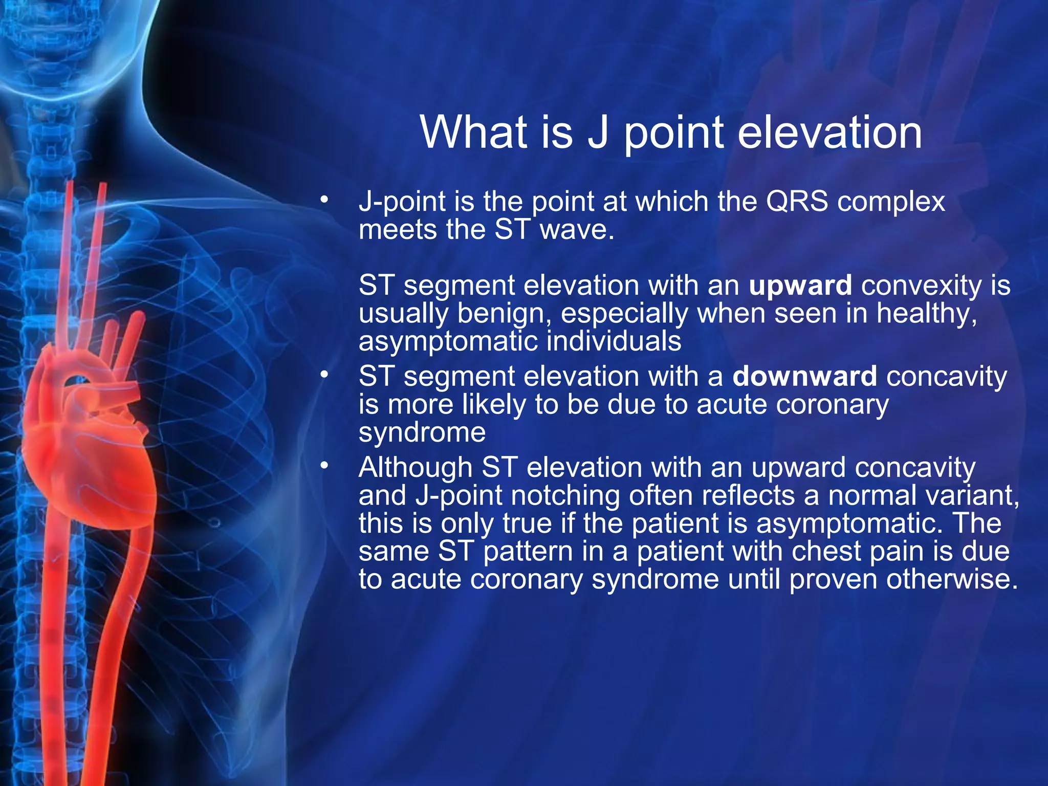 Acute coronary syndrome presentation with bivalirudin | PPT
