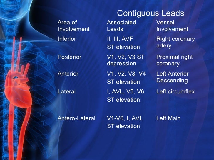 Acute coronary syndrome presentation with bivalirudin