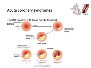 Acute Coronary Syndromes clinical presentation.ppt