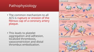 Acute Coronary Syndromes, department of Cardiology.pptx