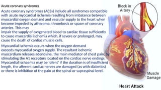 acute coronary syndroms applied therapeutic lecture | PPT