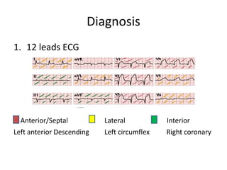 Acute Coronary Syndroms (ACS) by Feroz Khan RN.pptx