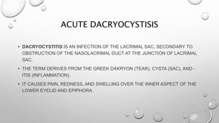 Acute dacryocystisis | PPTX