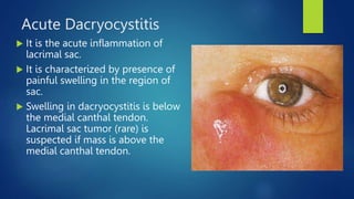 Acute Dacryocystitis | PPTX