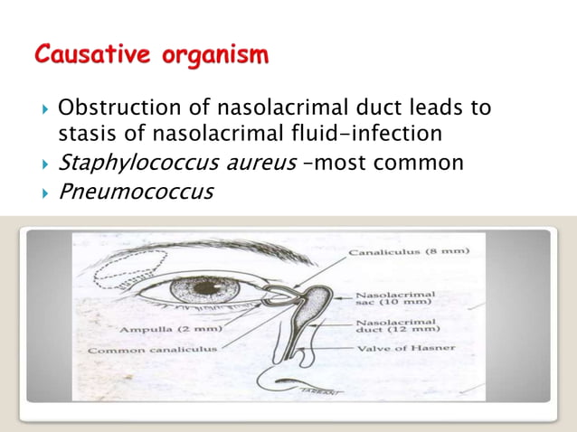Acute dacryocystitis | PPTX | Ear, Nose and Throat Conditions ...