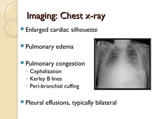 Acute decompensated heart failure | PPT