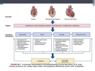 Acute decompensated heart failure | PPTX