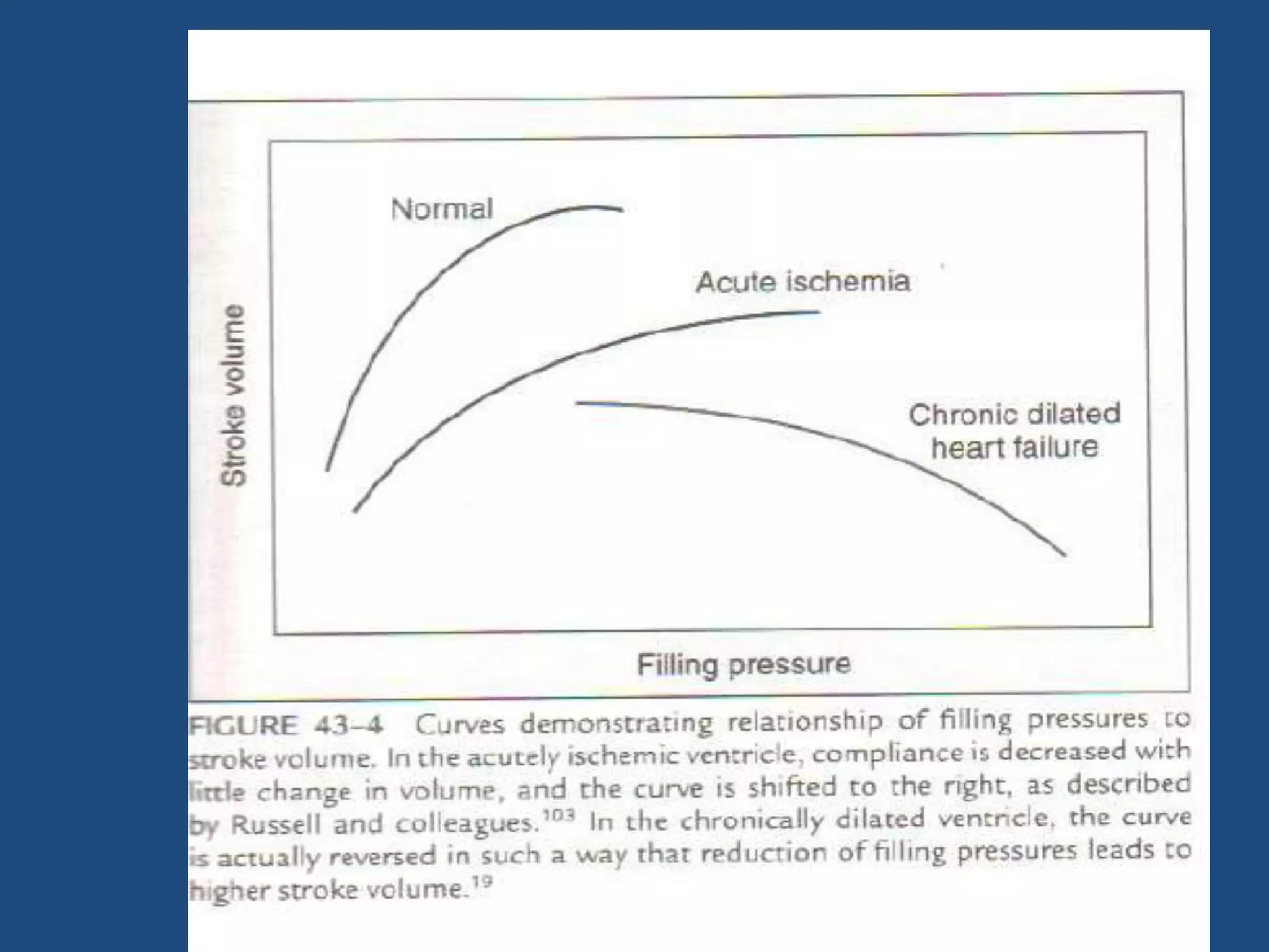 Acute decompensated heart failure | PPT