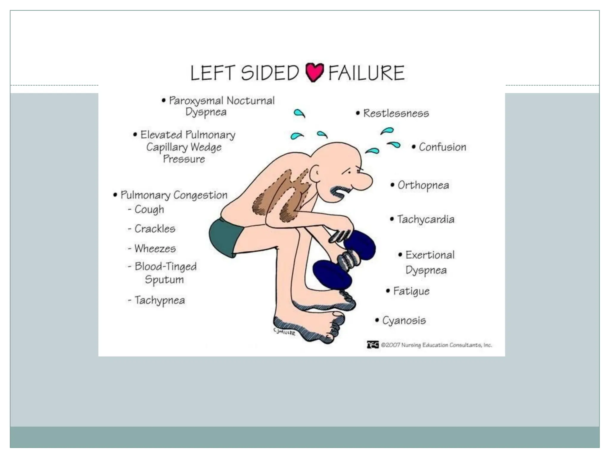 ACUTE DECOMPENSATING HEART FAILURE presentation for May 2017.pdf