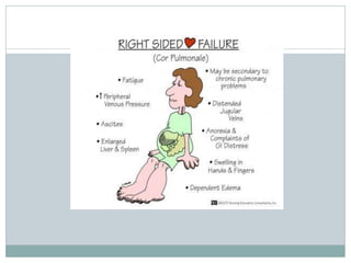 ACUTE DECOMPENSATING HEART FAILURE presentation for May 2017.pdf