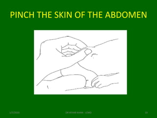 acute diarrheal disease and its prevention | PDF