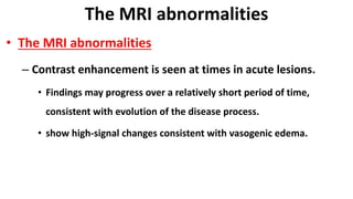 Acute disseminated encephalomyelitis | PPTX