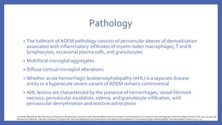 Acute Disseminated Encephalomyelitis | PPTX