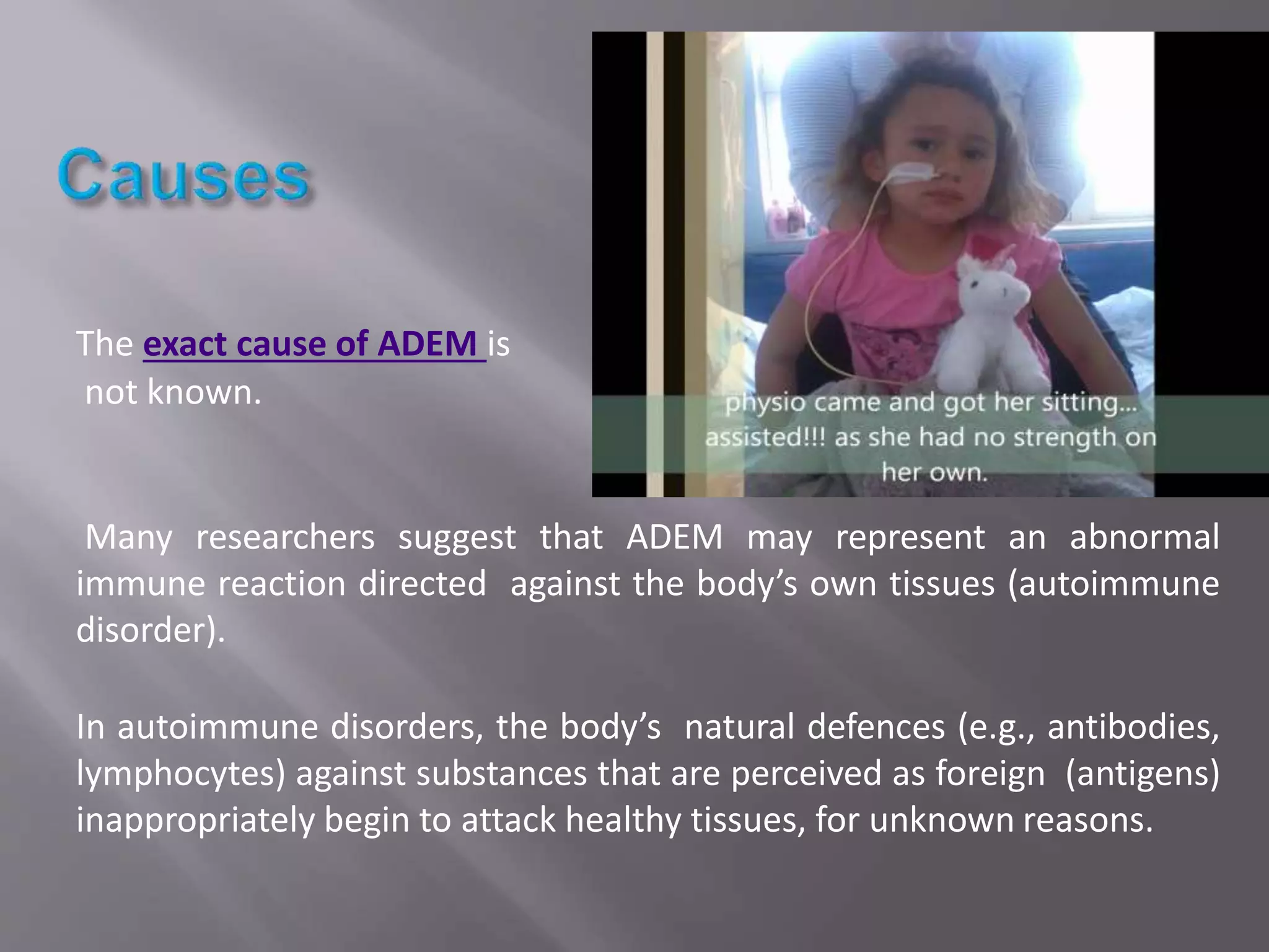 Acute Disseminated Encephalomyelitis | PPTX
