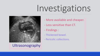 Acute diverticulitis | PPTX