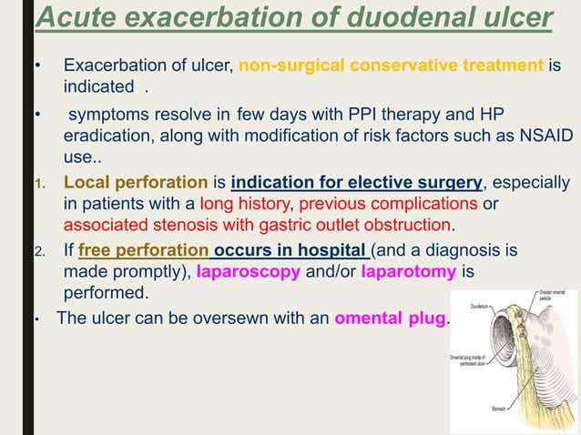 Acute epigastric pain | PPTX