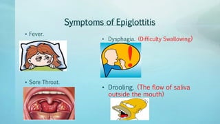 Acute epiglottitis by Joselyn | PPTX