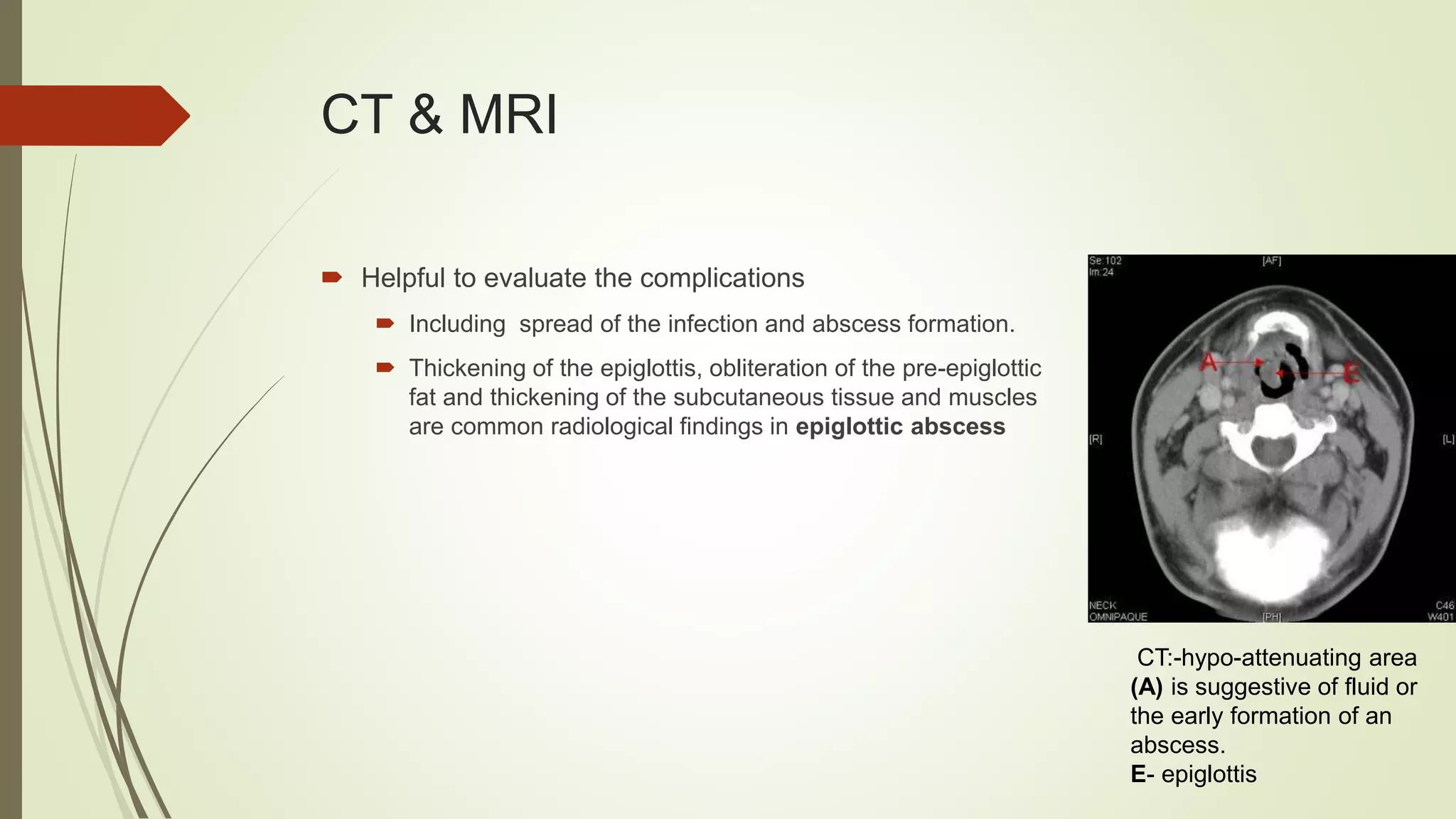 Acute epiglottitis | PPTX | Ear, Nose and Throat Conditions | Diseases ...