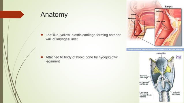 Acute epiglottitis | PPT
