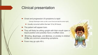 Acute epiglottitis | PPTX