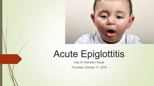 Acute epiglottitis | PPT