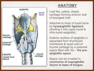 Acute Epiglottits (ppt) | PPTX