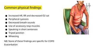 Management of acute Exacerbation of COPD.pptx