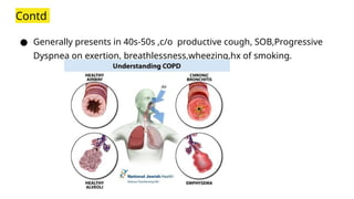 Management of acute Exacerbation of COPD.pptx