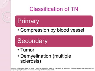 Acute Exacerbation of Trigeminal Neuralgia.pptx